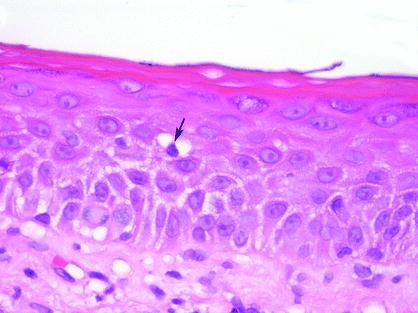 Normal Cutaneous Histology | SpringerLink