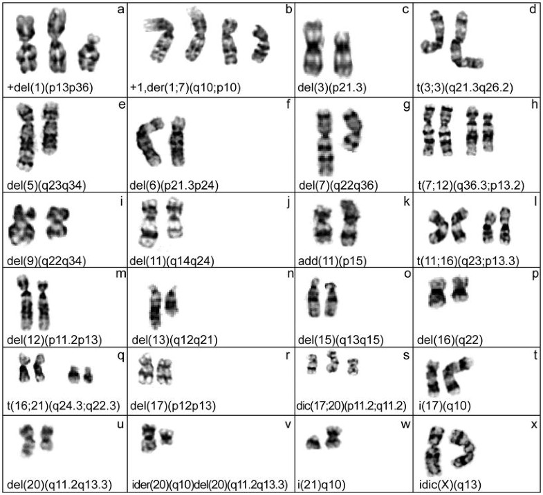 The Cytogenetics of Hematologic Neoplasms | SpringerLink