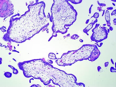 Chorionic Villi: Histology and Villous Development | SpringerLink