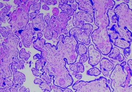 Chorionic Villi: Histology and Villous Development | SpringerLink