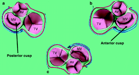 Vortex Formation in the Heart | SpringerLink