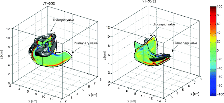 Vortex Formation in the Heart | SpringerLink