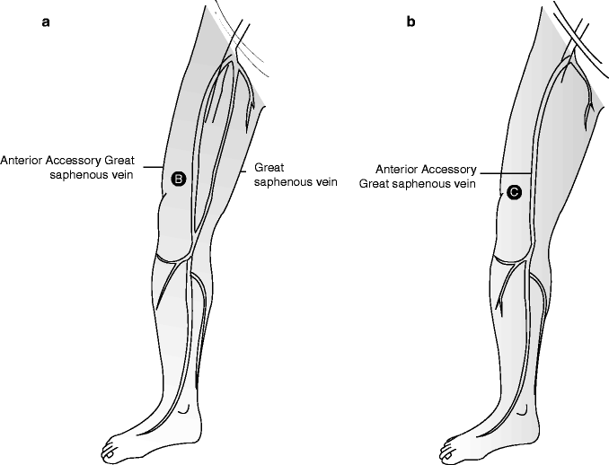 Venous Anatomy of the Lower Extremity | SpringerLink