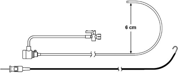 Transseptal Puncture | SpringerLink
