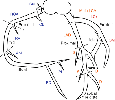 Optimal Angiographic Technique and Quantitative Analysis | SpringerLink