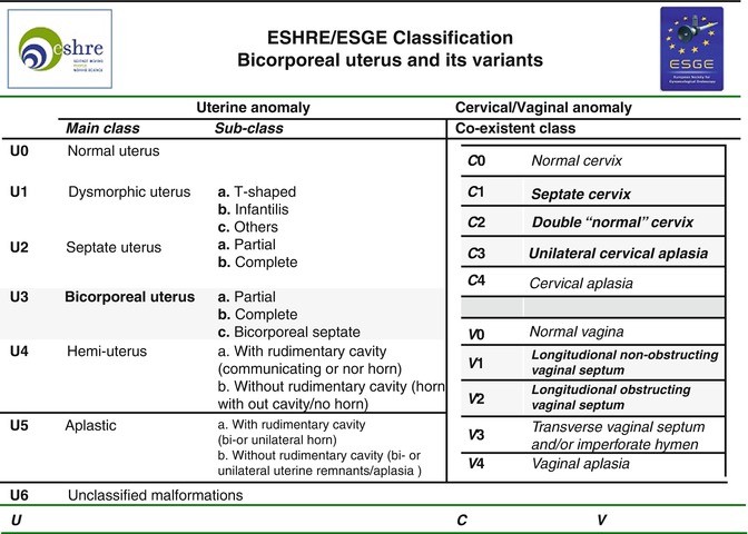 Bicorporeal Uterus: Treatment Options | SpringerLink