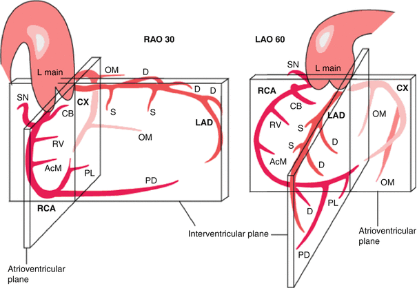 Qualitative and Quantitative Coronary Angiography | SpringerLink