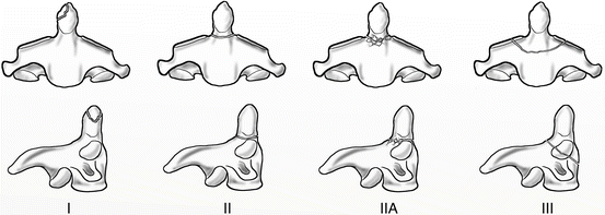 Odontoid Fracture | SpringerLink