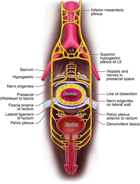 Total Mesorectal Excision with Autonomic Nerve Preservation: “Optimized ...
