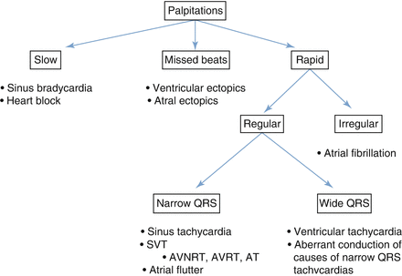 Palpitations | SpringerLink