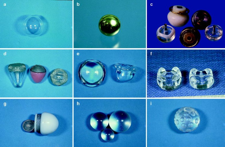 Enucleation, Evisceration, Secondary Orbital Implantation | SpringerLink