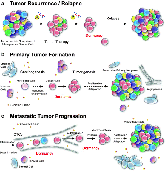 Tumor Dormancy and Cancer Stem Cells: Two Sides of the Same Coin ...