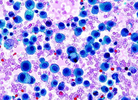 Normal Cytology | SpringerLink