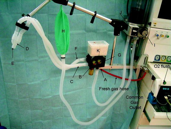 Oxygen Delivery Systems and the Anesthesia Workstation | SpringerLink