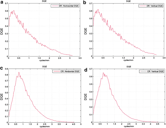 Digital Radiography Detector Performance | SpringerLink