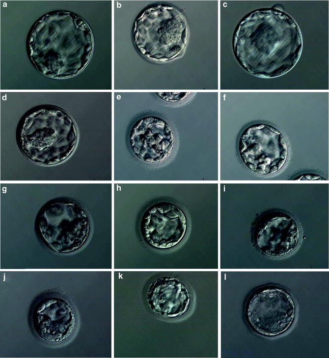 Morphological Assessment of Blastocyst Stage Embryos: Types of Grading ...