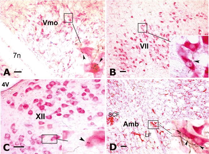 Brain Tissue Preparation, Sectioning, and Staining | SpringerLink