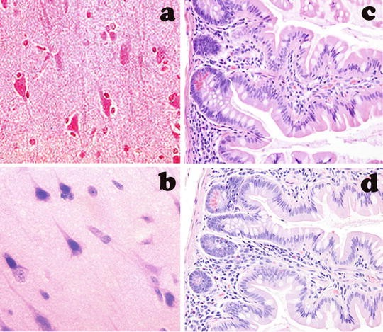 Brain Tissue Preparation, Sectioning, and Staining | SpringerLink