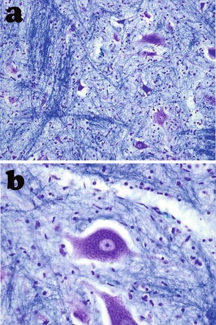Brain Tissue Preparation, Sectioning, and Staining | SpringerLink