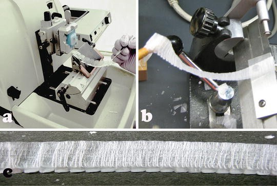 Brain Tissue Preparation, Sectioning, and Staining | SpringerLink