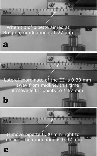 Brain Stereotaxic Injection | SpringerLink