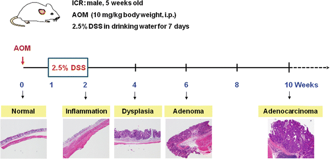 The Azoxymethane Plus Dextran Sulfate Sodium-Induced Mouse Colon Cancer ...