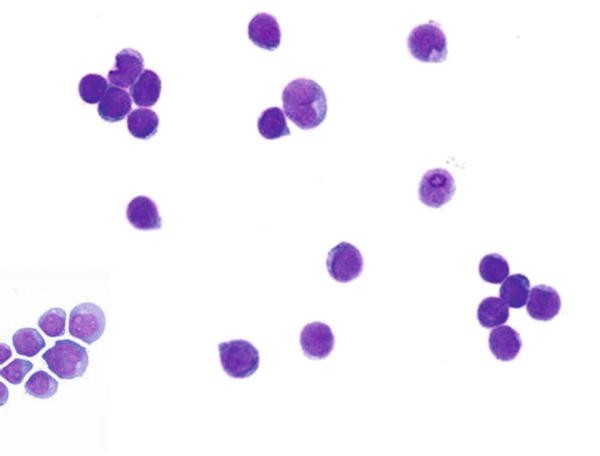 Cerebrospinal Fluid (CSF) Cytology | SpringerLink