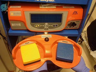 Bipolar TURP | SpringerLink