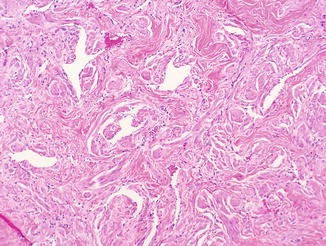 Normal Vulva: Embryology, Anatomy, and Histology | SpringerLink