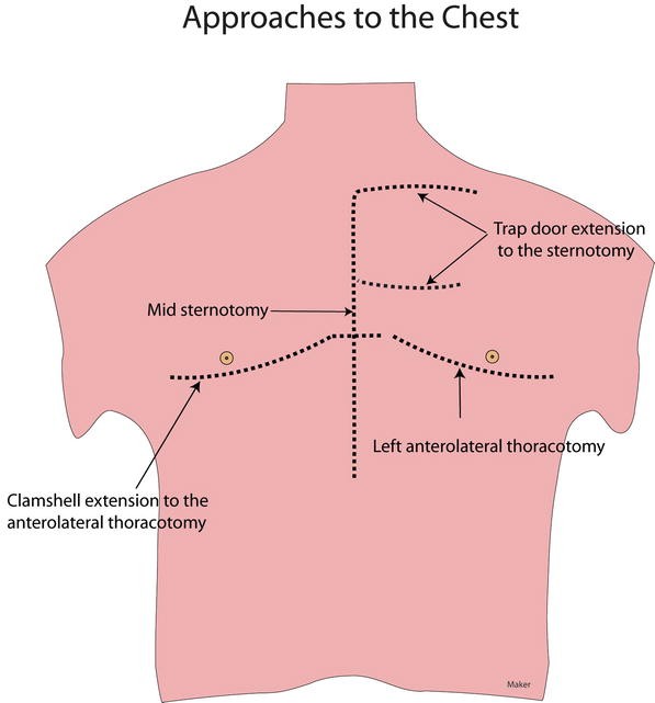 Mediastinum, Heart, and Great Vessels in the Thorax | SpringerLink