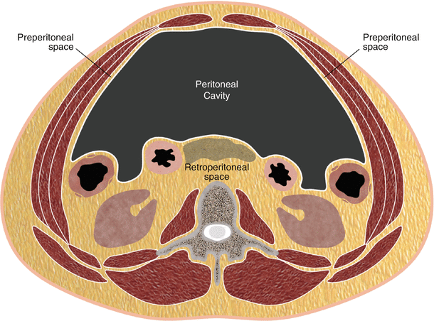The Extraperitoneal Spaces | SpringerLink