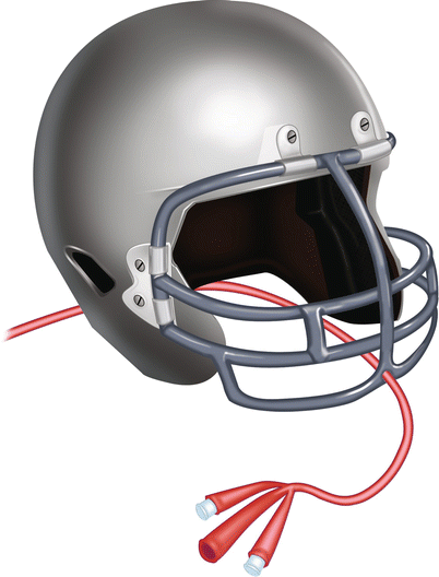 Sengstaken-Blakemore Tube | SpringerLink