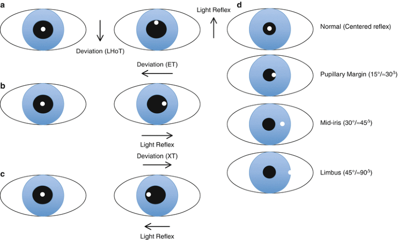 Approach to Visual Acuity Assessment and Strabismus Evaluation of the ...