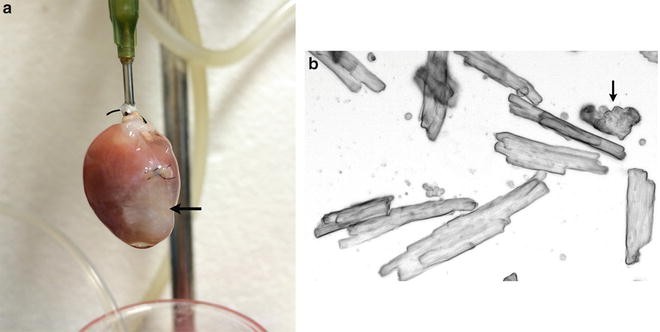 Cardiac Myocyte Exosome Isolation | SpringerLink