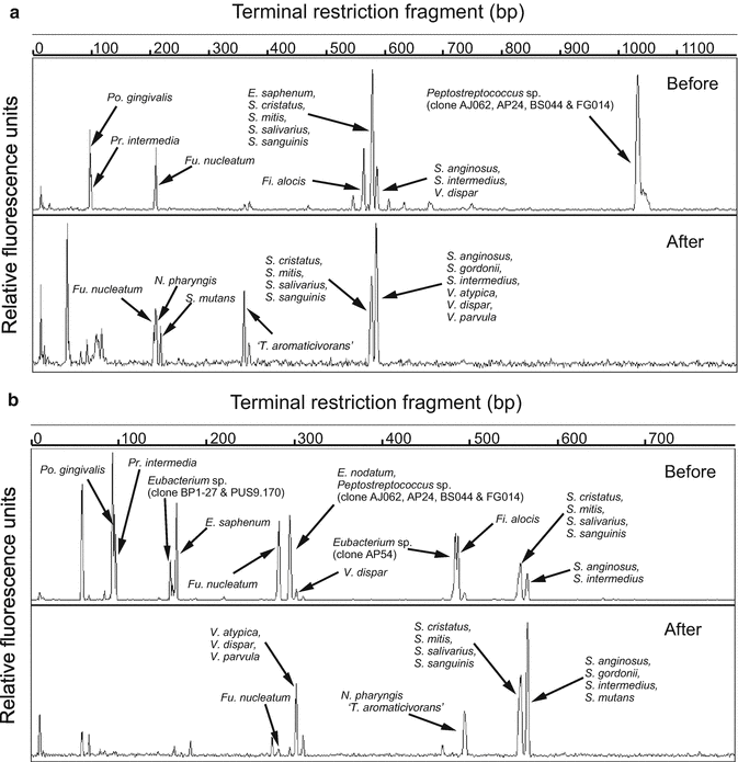Microbial Community Profiling Using Terminal Restriction Fragment Length Polymorphism (T-RFLP ...
