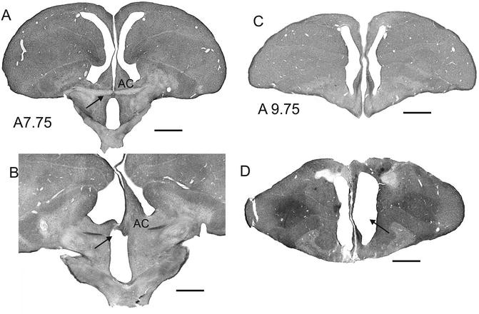 Unilateral Lesions | SpringerLink