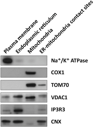 Isolation of Mitochondria-Associated Membranes (MAM) from Mouse Brain ...