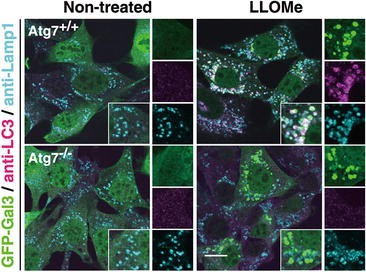 Lysophagy: A Method for Monitoring Lysosomal Rupture Followed by ...