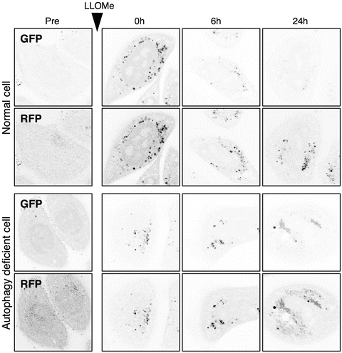 Lysophagy: A Method for Monitoring Lysosomal Rupture Followed by ...