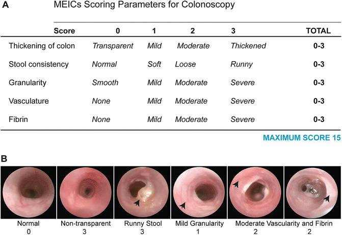 In Vivo Models of Inflammatory Bowel Disease and Colitis-Associated ...