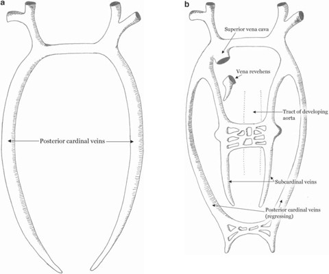 Inferior Vena Cava: Embryology and Anomalies | SpringerLink