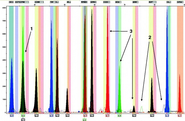 SNP Genotyping Using Multiplex Single Base Primer Extension Assays ...