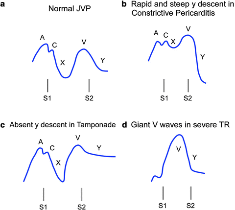 Key Clinical Findings | SpringerLink