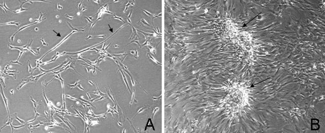 Human Vascular Smooth Muscle Cell Culture | SpringerLink