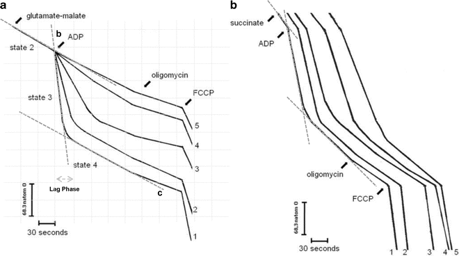 Evaluation of Respiration with Clark Type Electrode in Isolated ...