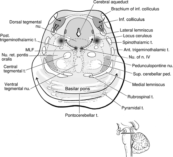Brainstem: Medulla, Pons, and Midbrain | SpringerLink