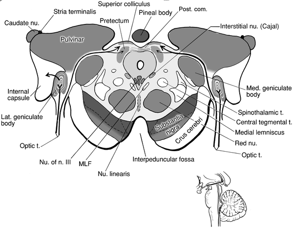 Brainstem: Medulla, Pons, and Midbrain | SpringerLink