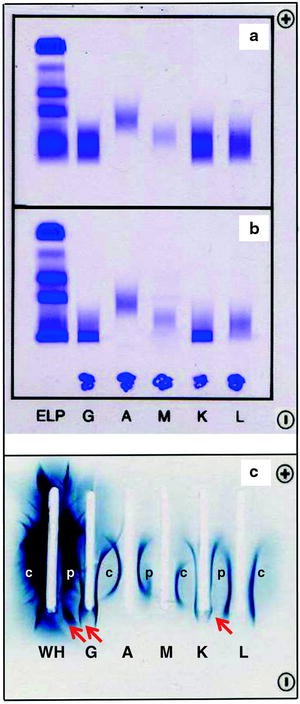 Immunoelectrophoresis: A Method with Many Faces | SpringerLink