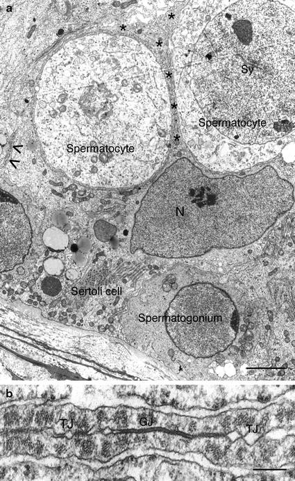 Ultrastructural Analysis Of Testicular Tissue And Sperm By Transmission