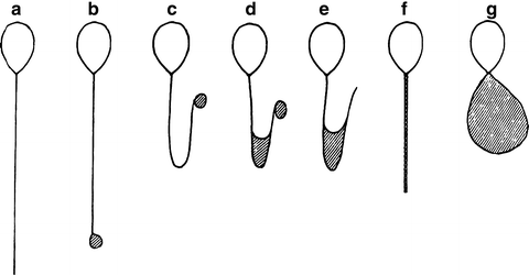 The Hypo-osmotic Swelling Test for Evaluation of Sperm Membrane ...